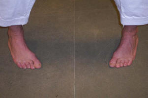 Dachi waza – Isshinryu